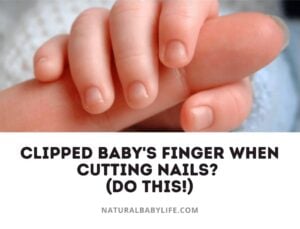 Clipped Baby's Finger When Cutting Nails? (Do This!)
